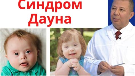 СИНДРОМ ДАУНА ДОКТОР ЖАЛИЛОВ Youtube