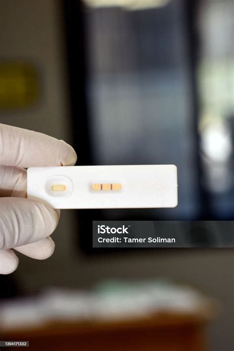 긍정적 인 임신 Hcg 테스트 인간 Chorionic Gonadotropin 테스트 가정용 빠른 소변 임신 테스트 카세트 건강 검진에 대한 스톡 사진 및 기타 이미지