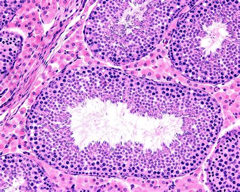 Leydig Cells Light Micrograph Stock Image C0475730 Science