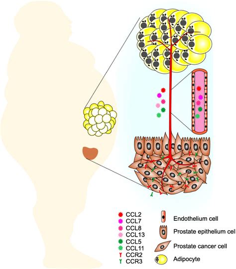 Ccl2 Ccr2 Signaling In Cancer Pathogenesis Pmc