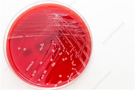 Pasteurella Multocida Culture Stock Image C035 7526 Science Photo