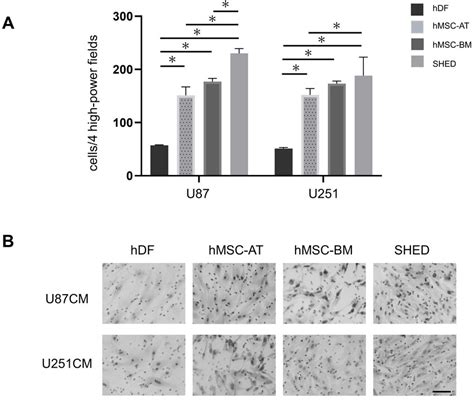In Vitro Migration To Glioma Conditioned Medium Induced Migration Of