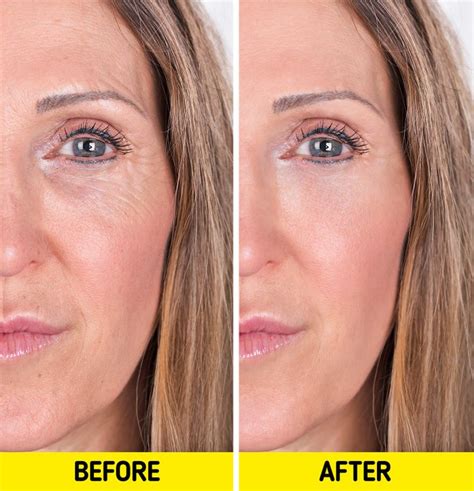 Rice Water Face Before And After See The Shocking Results Of This