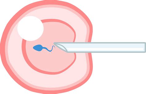 Ivf Icsi Vector Illustration Perfect For Presenting Anything About