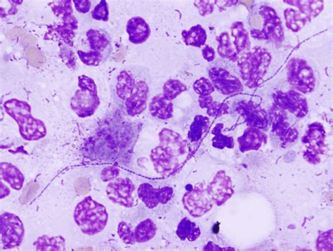 Infectious Nodular Skin Disease Flashcards Quizlet
