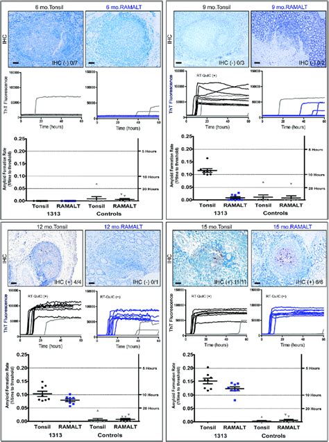Rt Quic Seeding Activity Precedes Ihc Detection Of Prp Cwd In Tonsil Download Scientific