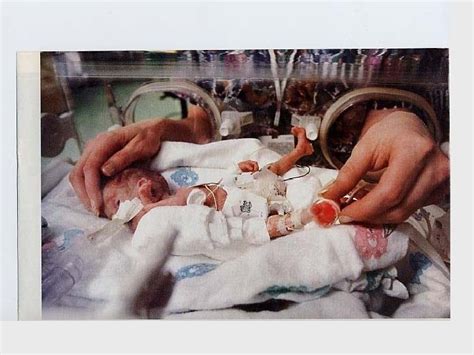 The Nicu Experience Its Impact And Implications Ntac