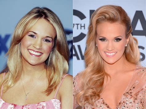 Celebrity Carrie Underwood Plastic Surgery Photos Video