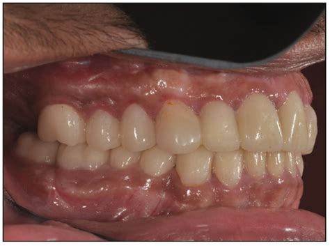 An Interdisciplinary Approach To The Treatment Of Amelogenesis