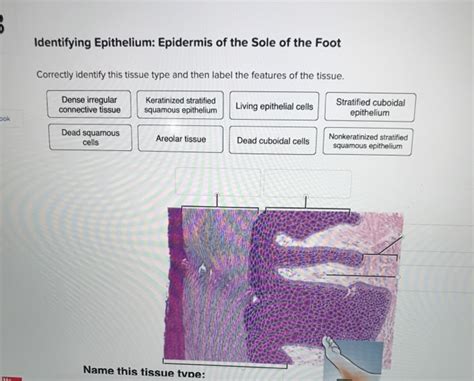 Solved 3 Identifying Epithelium Epidermis Of The Sole Of Chegg