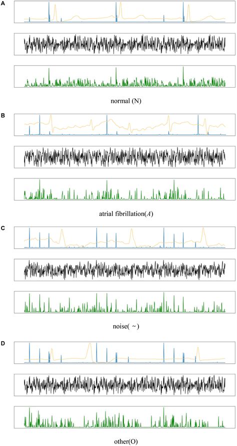 Frontiers Hadln Hybrid Attention Based Deep Learning Network For