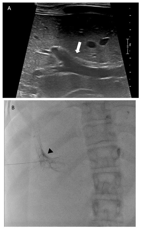 Lymphatics An Open Access Journal From Mdpi