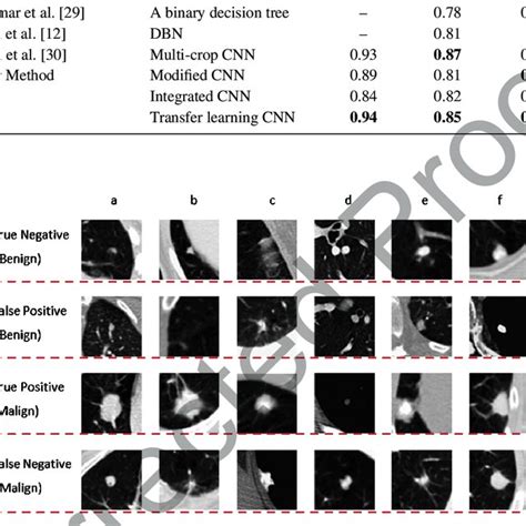 Samples Of Pulmonary Nodule Classification Results Download Scientific Diagram
