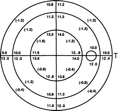 Chronic Simple Glaucoma 102 Right Eyes With Final Visual Acuity Of 6 6 Download High