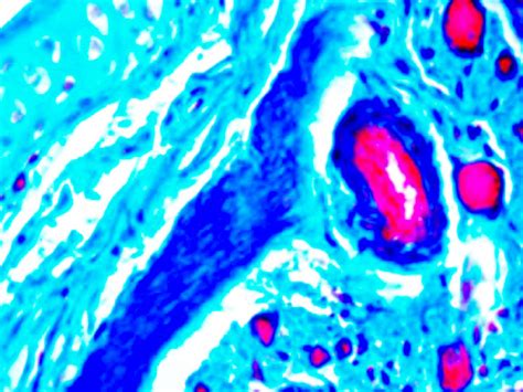 Trichrome Stain Kit Diagnostic Biosystems Dbs