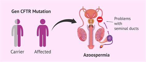 Cystic Fibrosis Gene