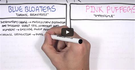 Copd Differences Between Chronic Bronchitis And Emphysema Copd News Today