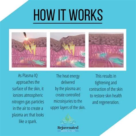 Rejuvenated Medical Spa Plasma Pen Skin Tightening Northwest Arkansas