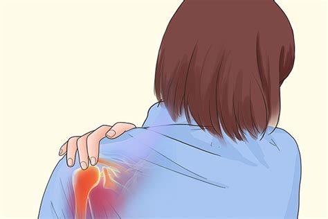 肩周炎如何用药才对彩牛养生