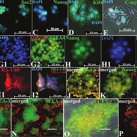 In Vitro Differentiation Of HIDPSCs IPSCs A Floating Embryoid Body