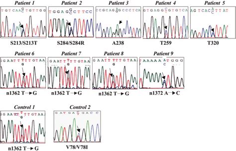 Direct Sequence Analysis Of The Amplified Spanning Exons 1 And 2 Exon