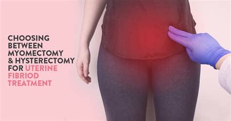 Uterine Fibroids Myomectomy Vs Hysterectomy Which One Should I Choose