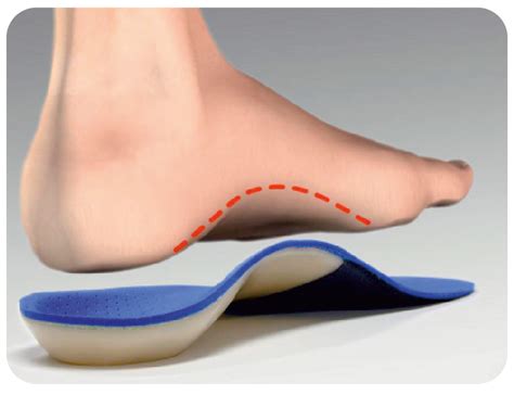 Gait Scan Analysis East Sussex Phoenix Health Hub