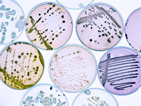 Microbiome Engineering Group Luxembourg Institute Of Science And Technology