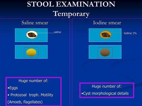 Ppt Laboratory Diagnosis Of Parasitic Infections Powerpoint