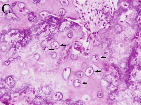 Endochondral Ossification Histology Normal Histology