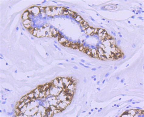 Calponin Rabbit Mab Sab Signalway Antibody