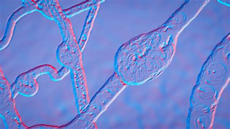 Diabetic Retinopathy Understanding Prevention And Management