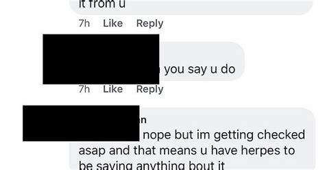 The Herp Accusations Abound Album On Imgur