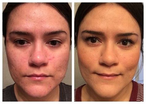 31 Amazing Skin Care Products With Over 1000 Reviews