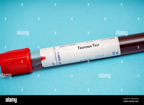 Troponin Test This Test Measures The Levels Of Troponin A Protein