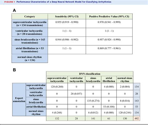 figure 1 from machine learning driven improvement of signal detection by implantable cardiac