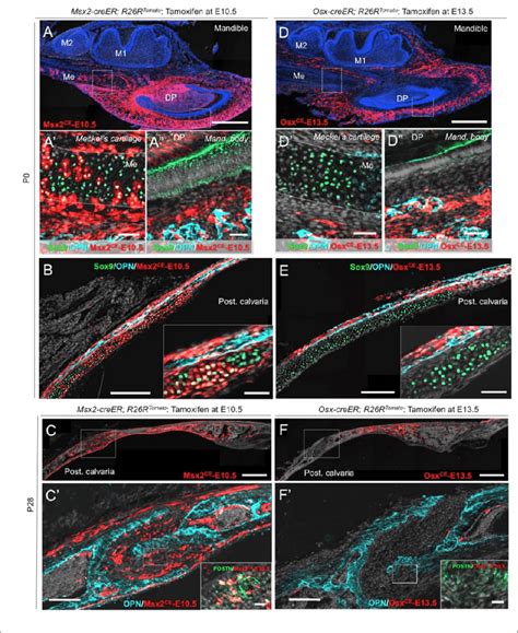 Msx2 Creer Early Mesenchymal Cells Exhibit Broader Differentiation