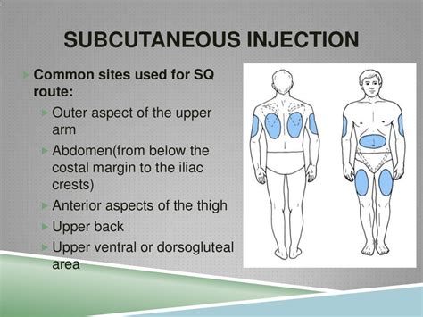Injection Technique