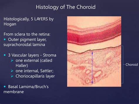 Physiology Of The Choroid Lectures Notes 2ppt