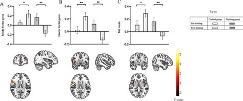 Pre To Post Bold Response Decreases In The A Left Middle Frontal Download Scientific Diagram