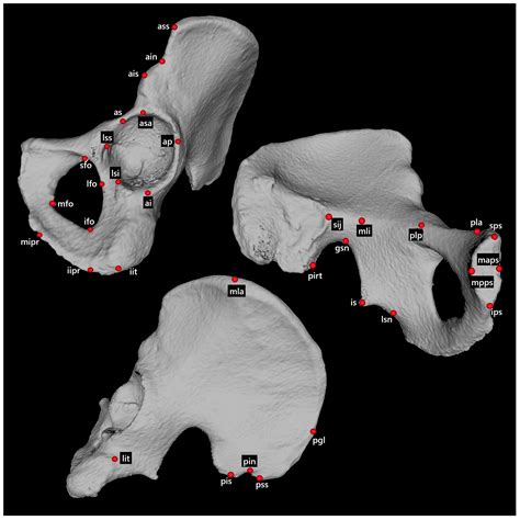 Evaluating The Effectiveness Of Coxal Bone Measurements For Sex