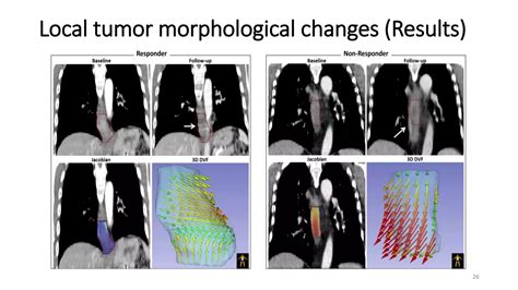 Artificial Intelligence In Radiation Oncology Pptx