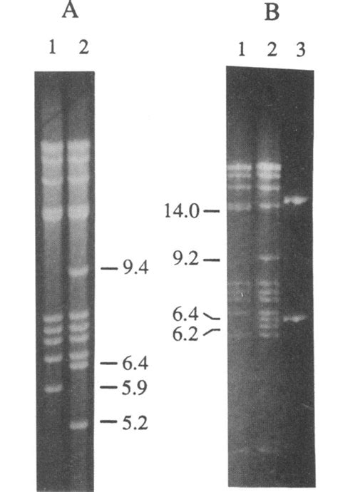 Agarose Gel Electrophoresis Showing Altered Restriction Patterns Of