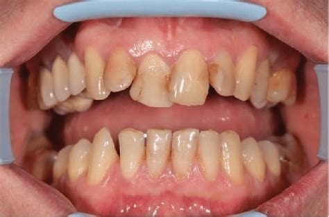 Preoperative Photograph Download Scientific Diagram