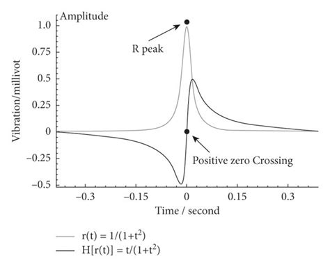 Relationship Between The R Peak And Positive Zero Crossing Download