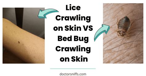 What Do Bed Bugs Look Like Bed Bug Bites Explained Th