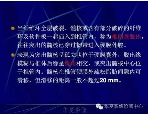 详细的腰椎解剖，椎间盘突出、膨出？看这里！ 好医术文章 好医术 赋能医生守护生命