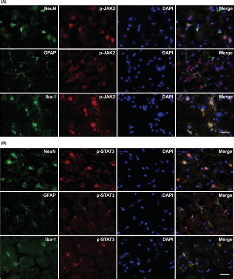 Phosphorylated Janus‐activated Kinase 2 P‐jak2 And Phosphorylated