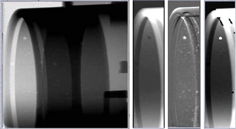 Figure 1 From Defect Detection Method In Digital Radiography For Porosity In Magnesium Castings