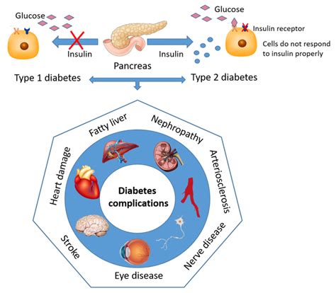 Diabetes Complications
